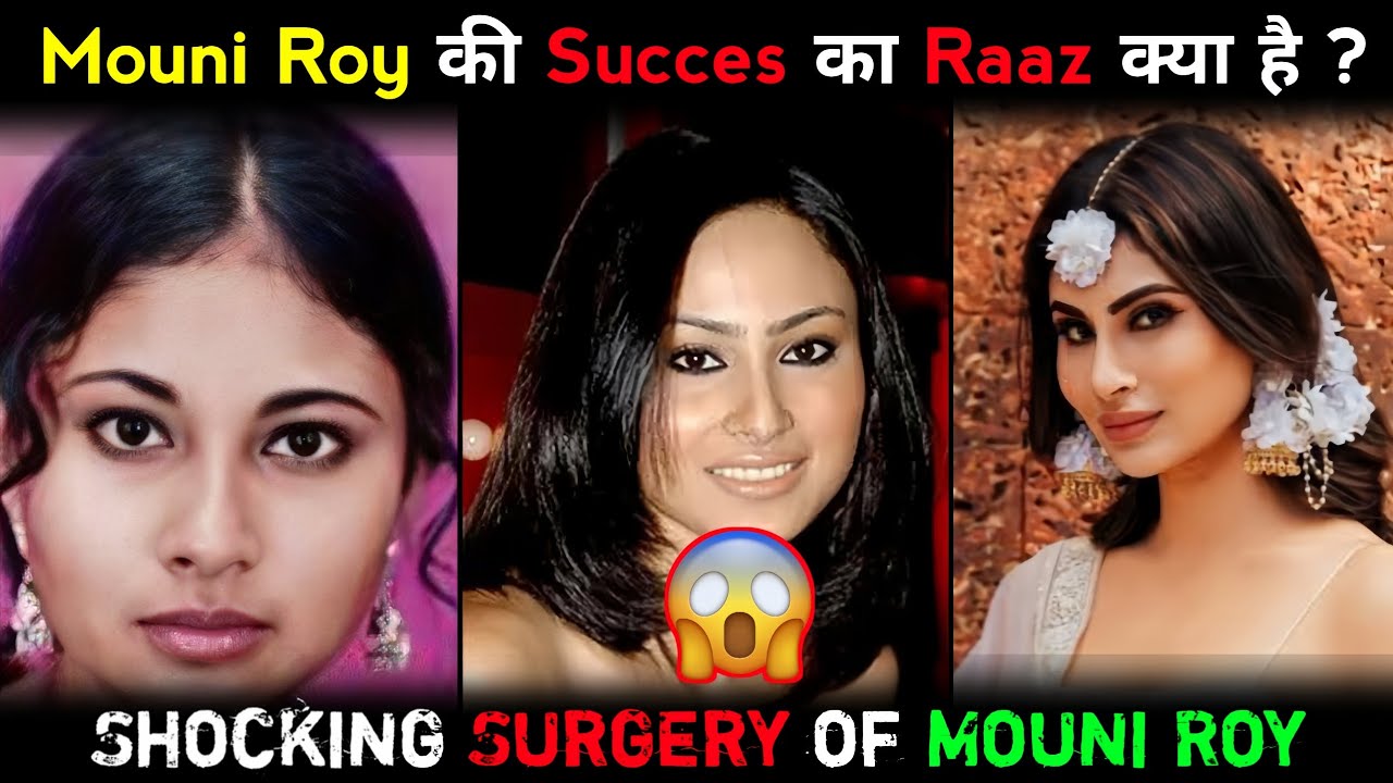 Mouni Roy ने इतनी बार Plastic Surgery करवाई है ? Shocking Plastic ...