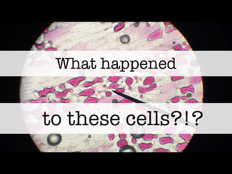 Red Onion Osmosis - Plasmolysis - Microscope