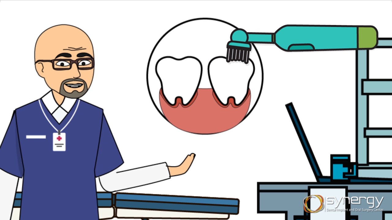 Oral Surgery Post Operative Instructions From Synergy Dental Implant ...