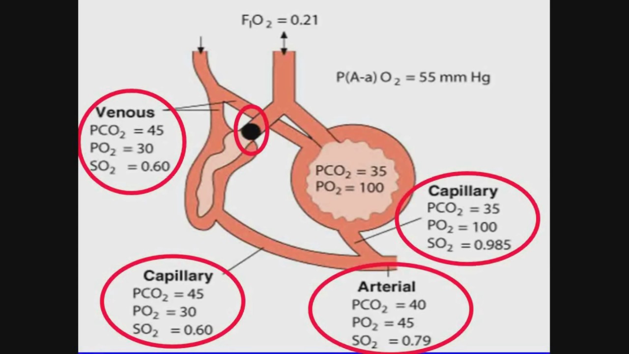 RSPT 1050 Module I and J - YouTube