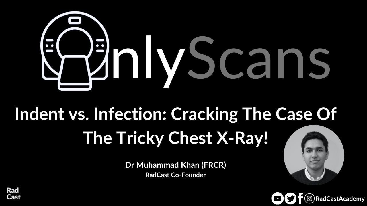 OnlyScans Radiology Review: Indent vs. Infection - Cracking The Case Of ...