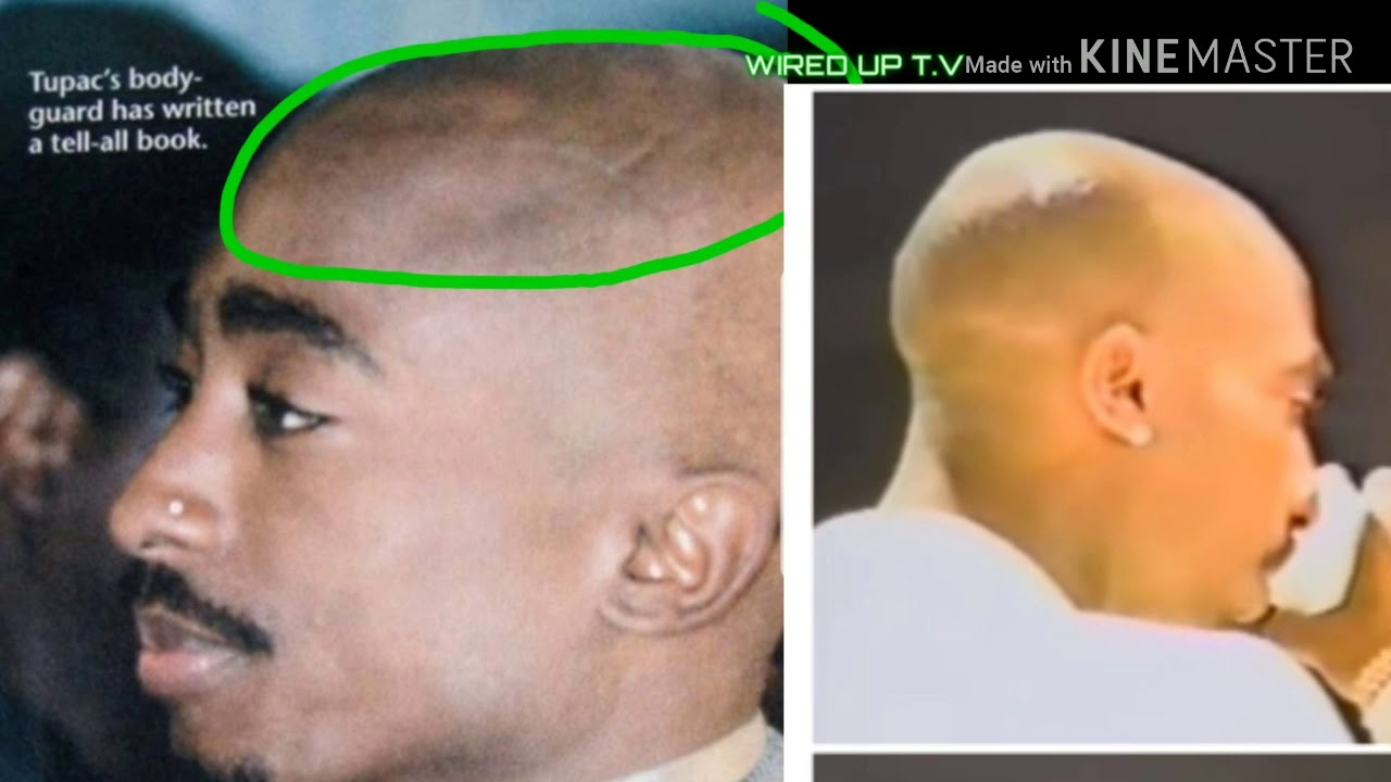 TUPAC ALIVE : PROOF TUPAC WAS SHOT 5 TIMES!!! FROM THE HORSES MOUTH ...