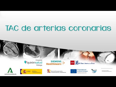 Angiotac Coronario: Todo Lo Que Debes Saber | Doctor Online