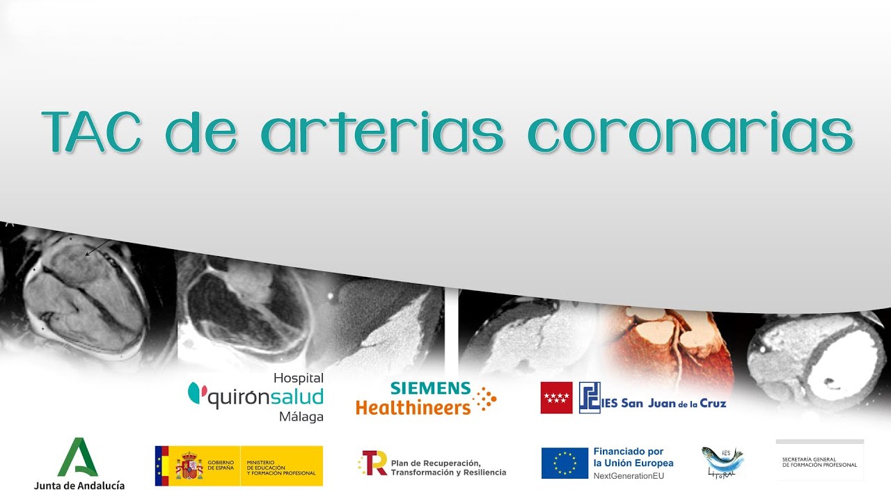 ANGIOTAC CORONARIO - YouTube