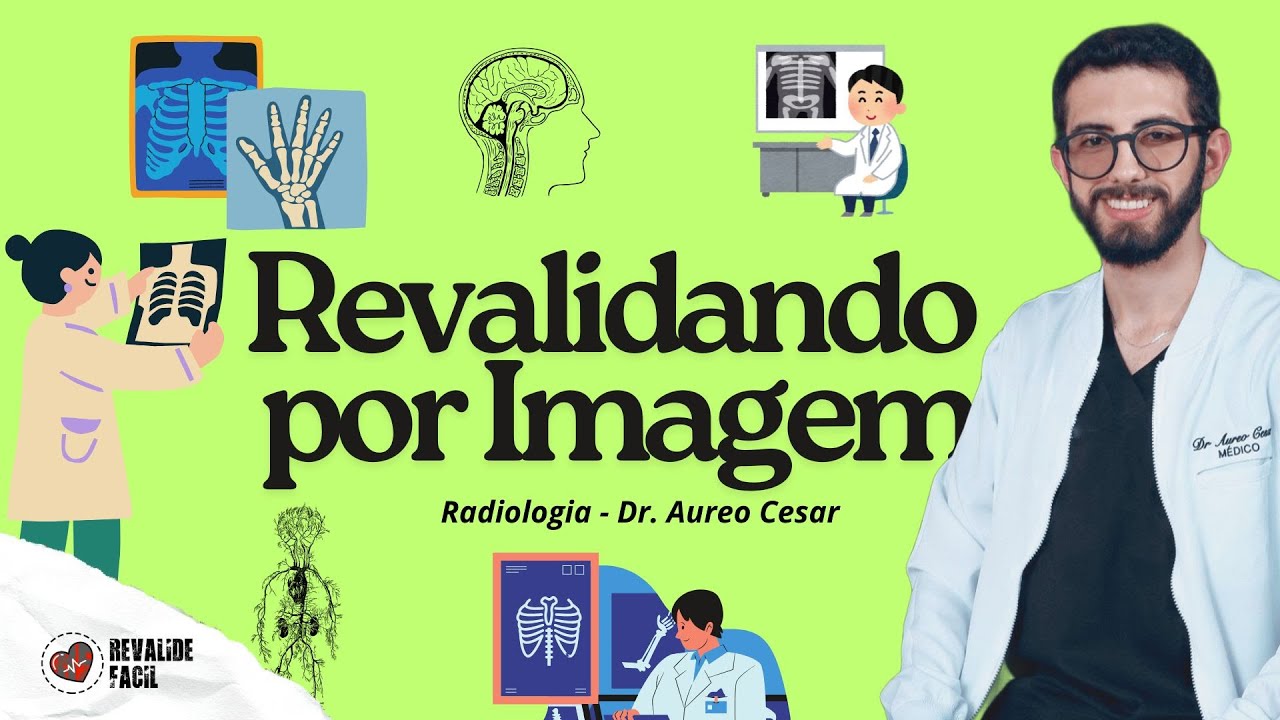 Revalidando por Imagens - Radiologia para o Revalida - YouTube