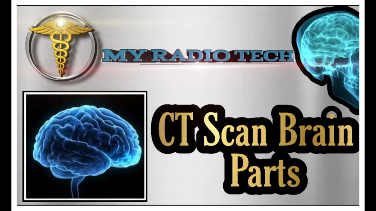 Anatomy of Brain in CT Brain Scan - YouTube