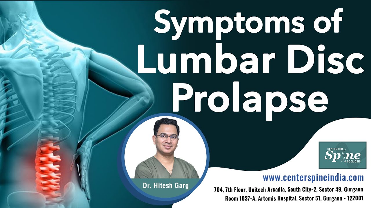 Lumbar Disc Herniation Symptoms