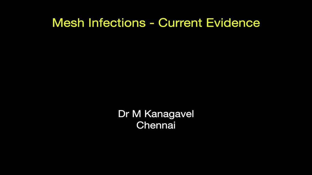 Mesh infections - current evidence - YouTube