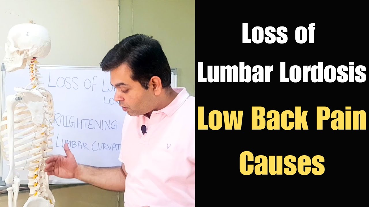 Loss of Lumbar Lordosis, Straightening of Lumbar Spine, Spine Curvature ...