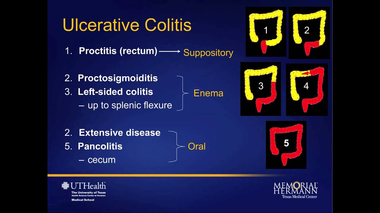 Inflammatory Bowel Disease with Dr. Andrew DuPont - YouTube