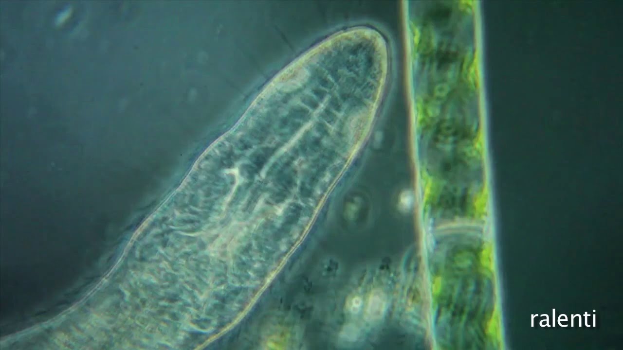 Stenostomum leucops, turbellarié d'eau douce - YouTube