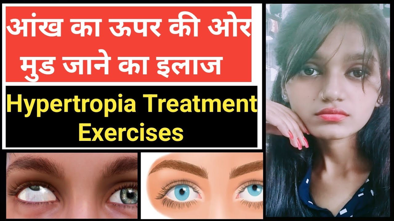 Hypertropia Exercise L Hypertropia Treatment Exercise L Squint Eye Exercises L Janhavi