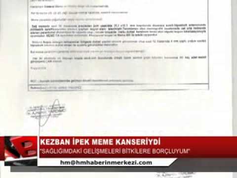 18 KEZBAN İPEK   MEME KANSERİ