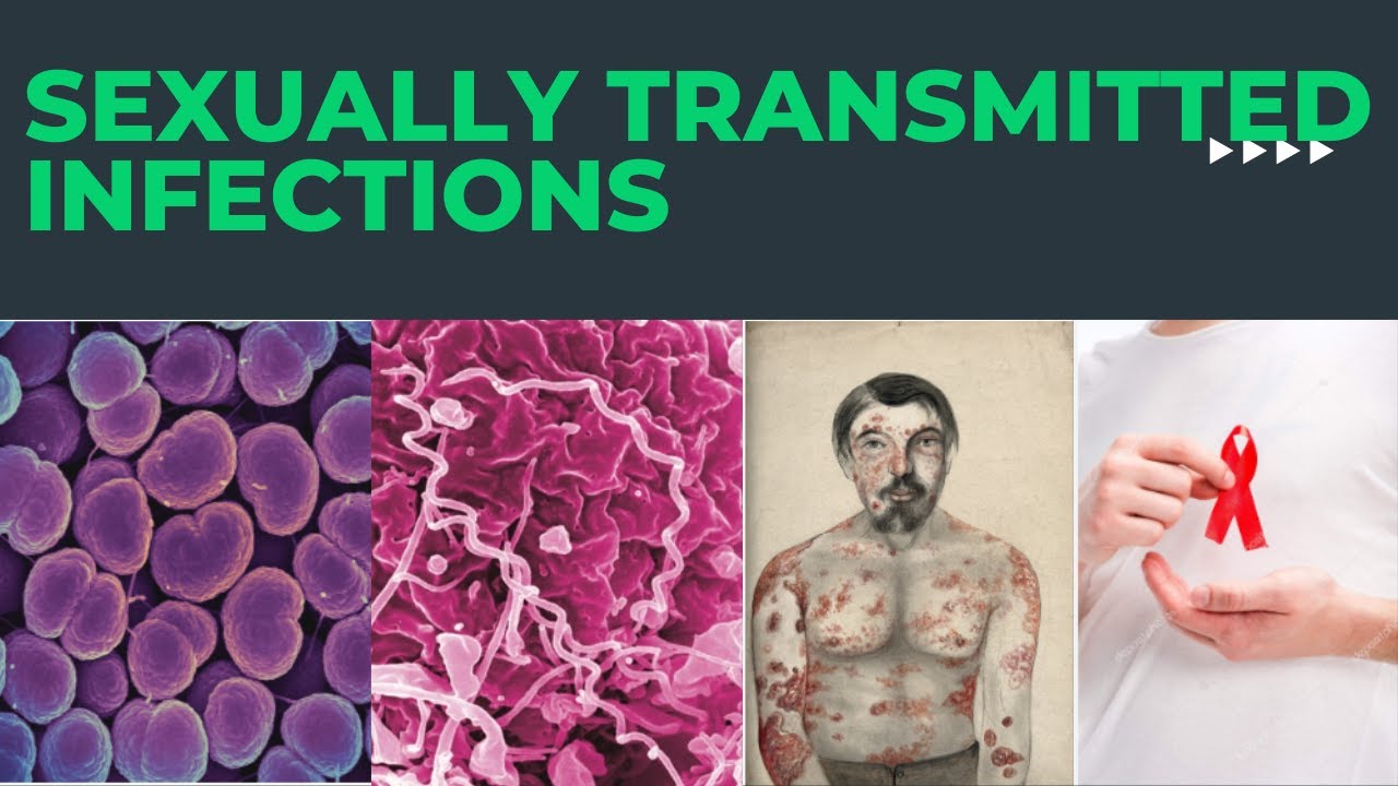 Sexually transmitted infections - YouTube