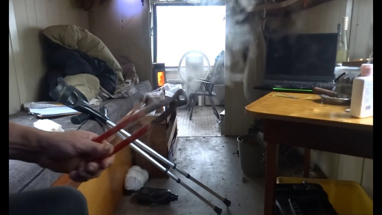 Taking my stitches out - YouTube