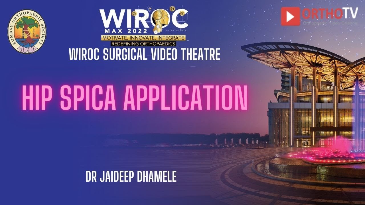 Hip Spica application Dr Jaideep Dhamele - YouTube