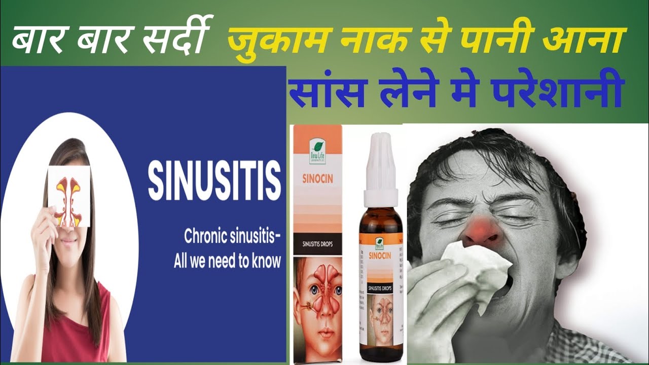 Sinusitis(Allergy) homeopathy medicine//सर्दी, जुकाम, एलर्जी की बेस्ट ...