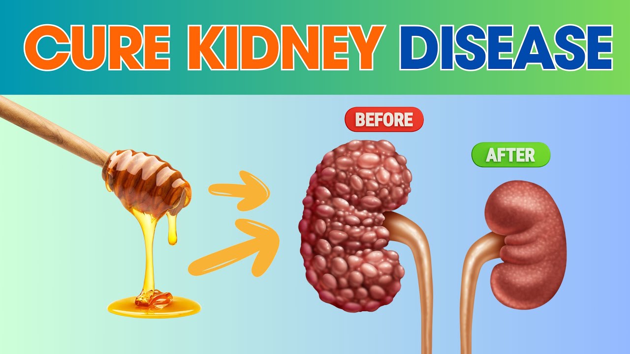 DO THIS! No Kidney Patient Will Ever Lose A Kidney | Health Helm - YouTube