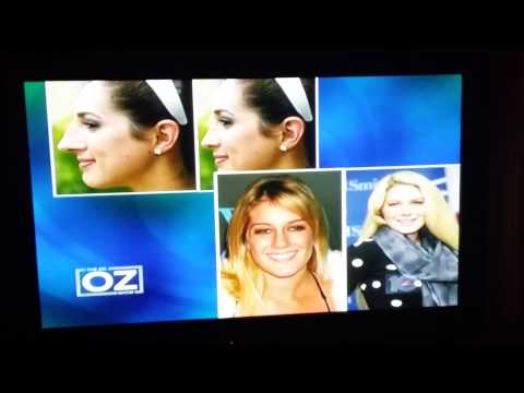 Lacey wildd dr oz
