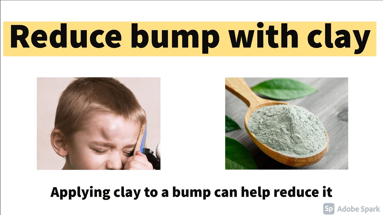 Reduce bumps with clay - Applying clay to a bumps can help to reduce it ...