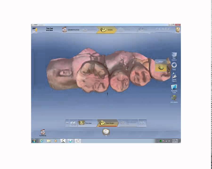 Cerec Connect 4.3 to Cerec Chair Side SW - YouTube