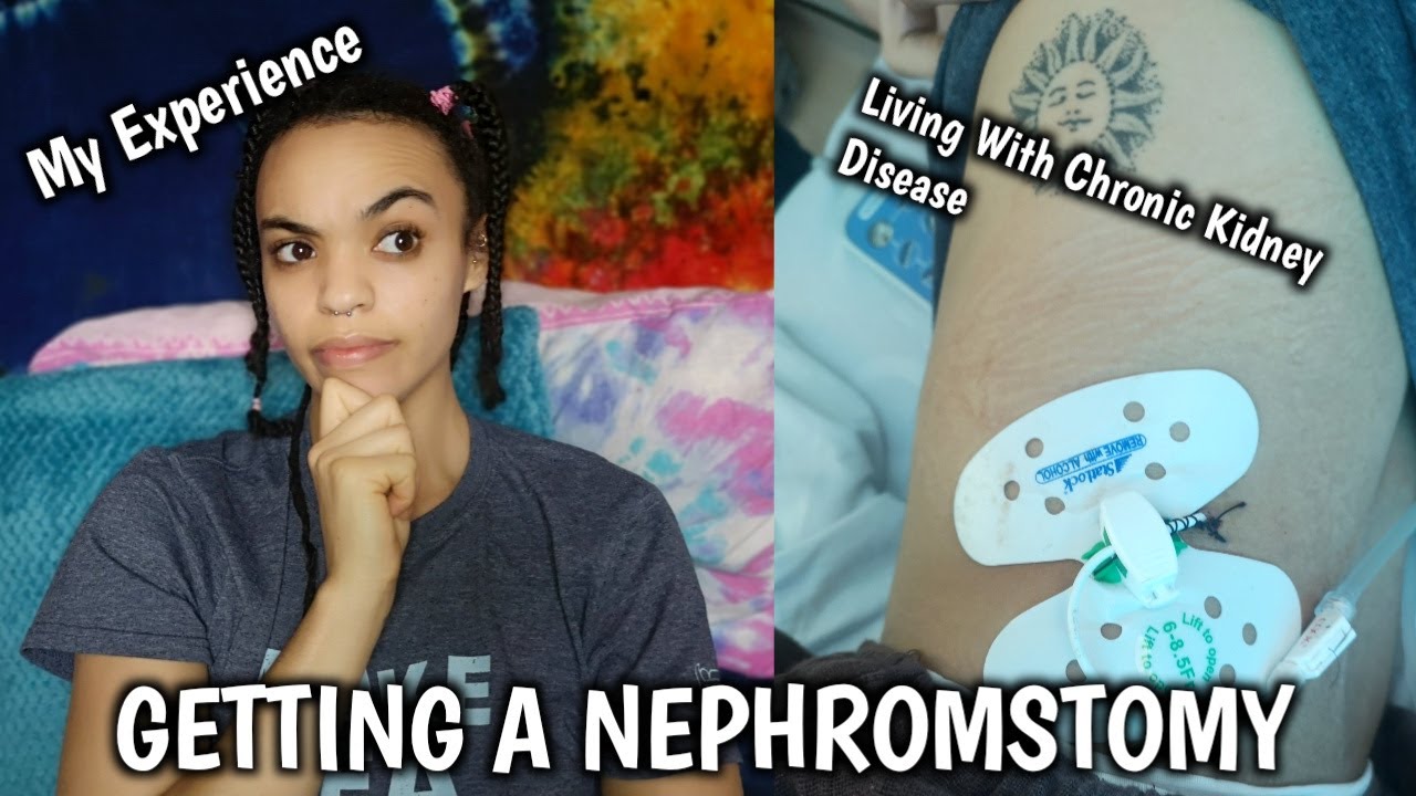 Getting A Nephrostomy My Experience Youtube