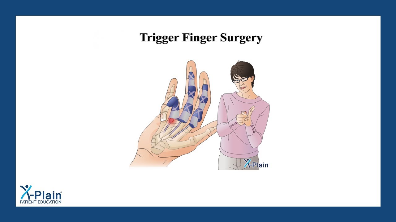 Trigger Finger Surgery - YouTube
