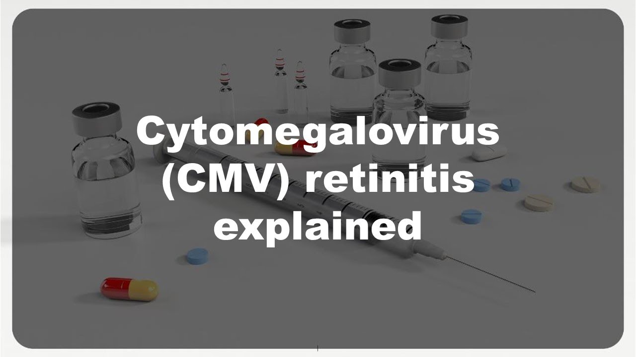 Cytomegalovirus (CMV) retinitis explained - YouTube