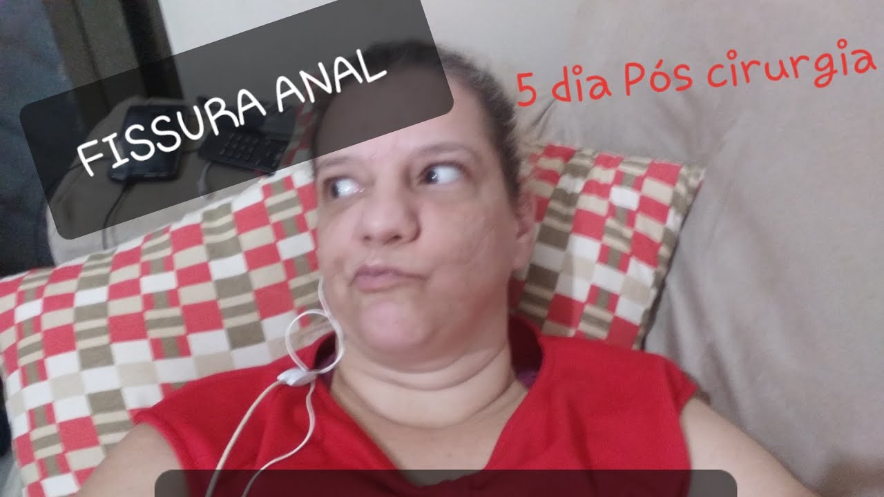 Fissura Anal Pós Cirurgia DiÁrio Da Cirurgia Youtube
