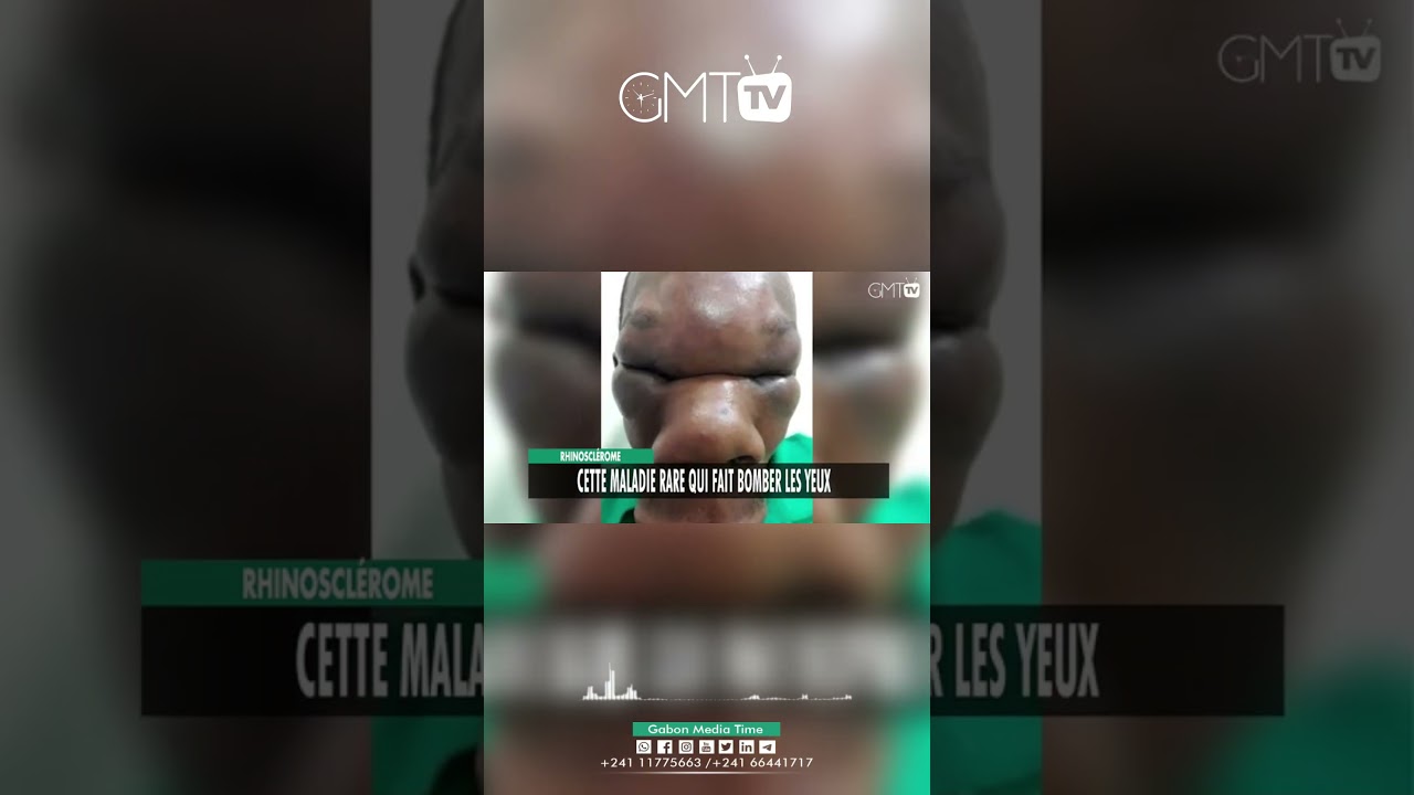 Gabon : Le guerrier Wongo sublimé par Oligui Nguema | Gabonmediatime ...