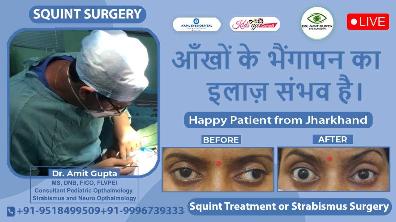 Live Squint Surgery by Dr. Amit Gupta Squint Specialist - YouTube