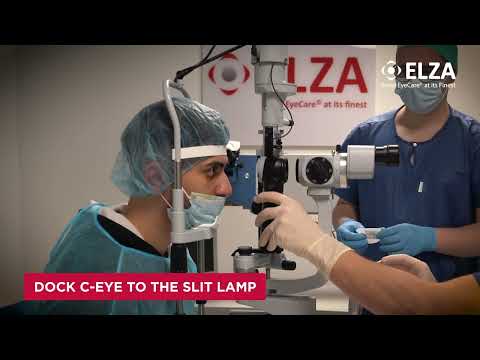 Cross-Linking (CXL) at the Slit Lamp April  2023
