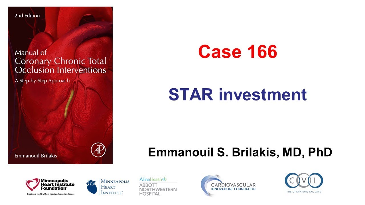 Case 166: Manual of CTO PCI - STAR investment - YouTube