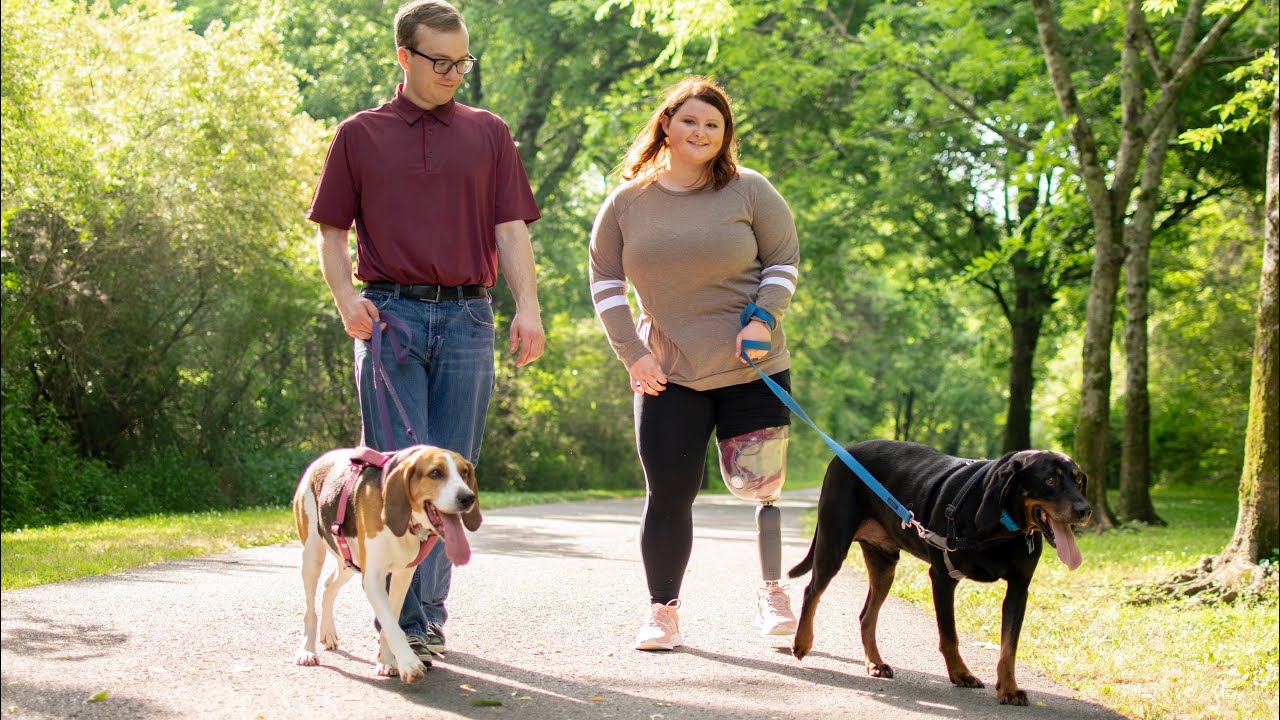 The Making of my Prosthetic Leg & How it Works (ft. Bulow Prosthetics ...