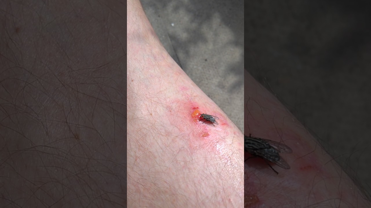 Fly eat wound - YouTube