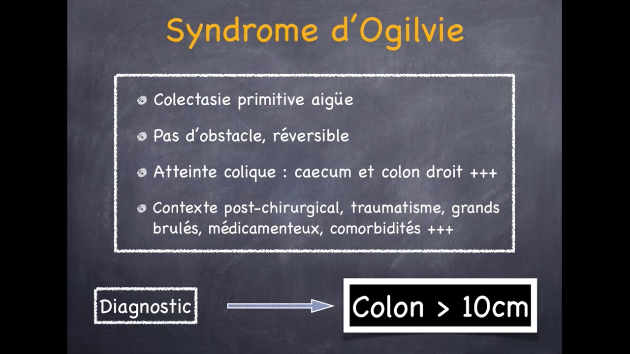 Occlusion intestinale - 5. Occlusion fonctionnelle - YouTube