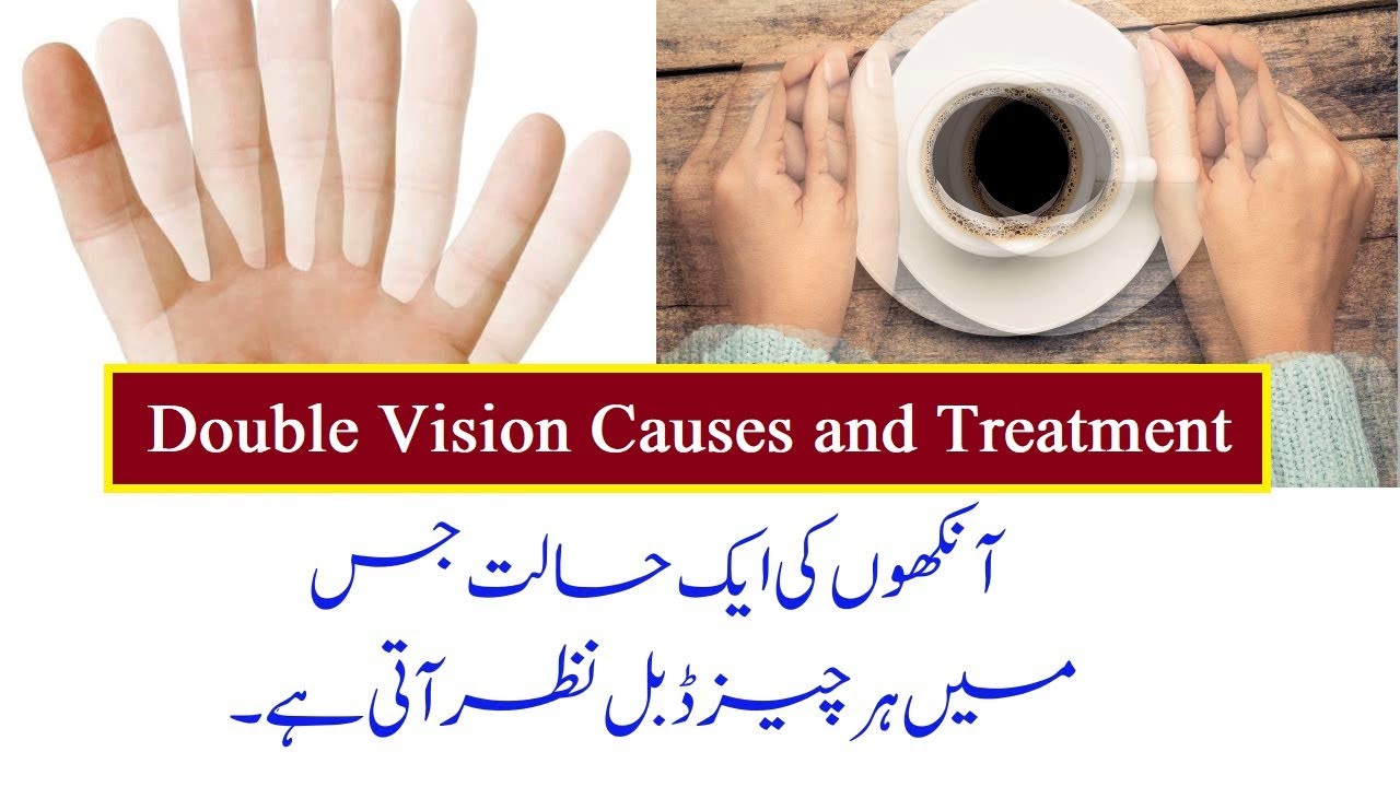 Double Vision Causes And Treatment Urdu Hindi YouTube double-vision-causes-and-treatment-urdu-hindi-youtube