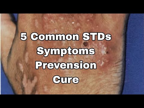 5 Most common STDs,Symptoms,cure and prevension - YouTube