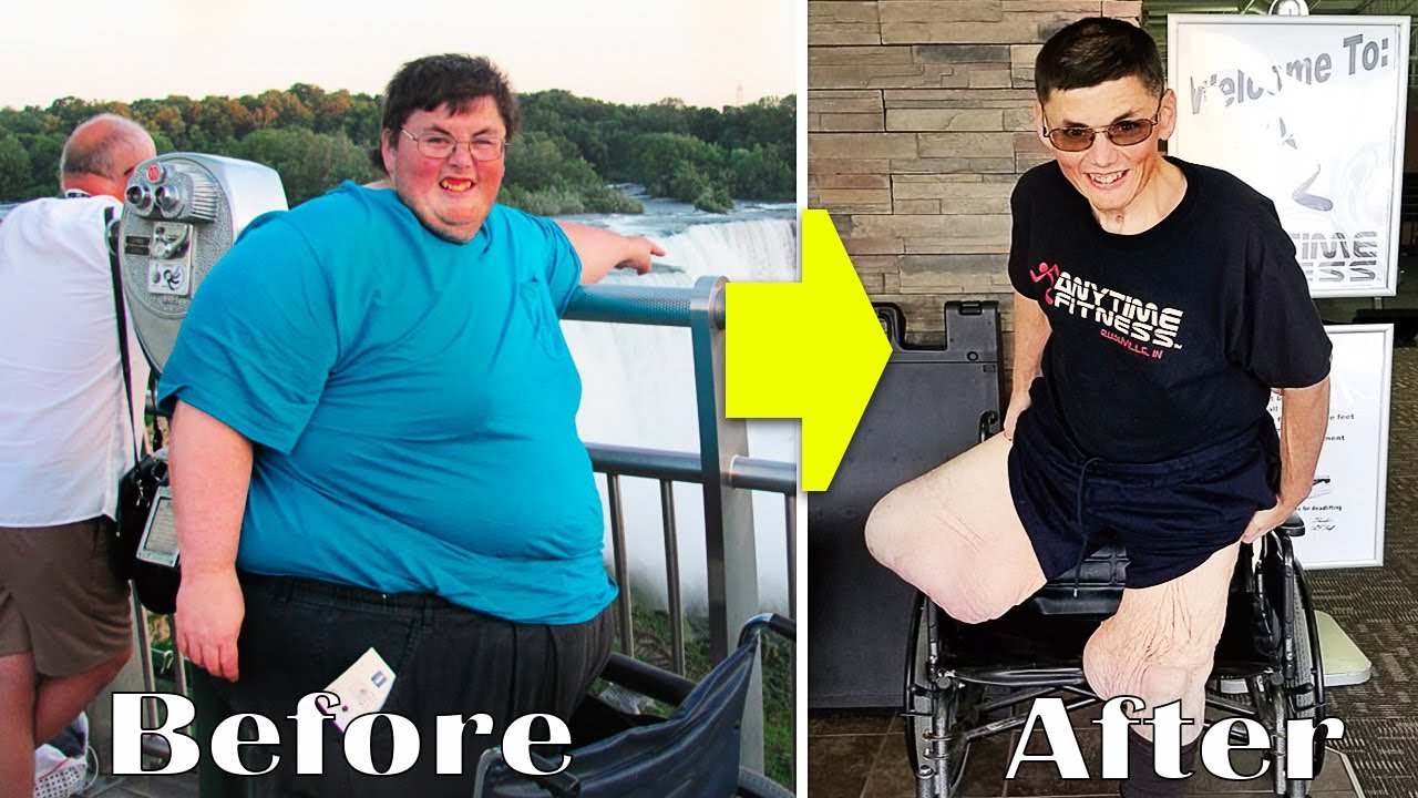 This Fat Man Was Told He Had Three Months To Live, Then He Lost 488 ...