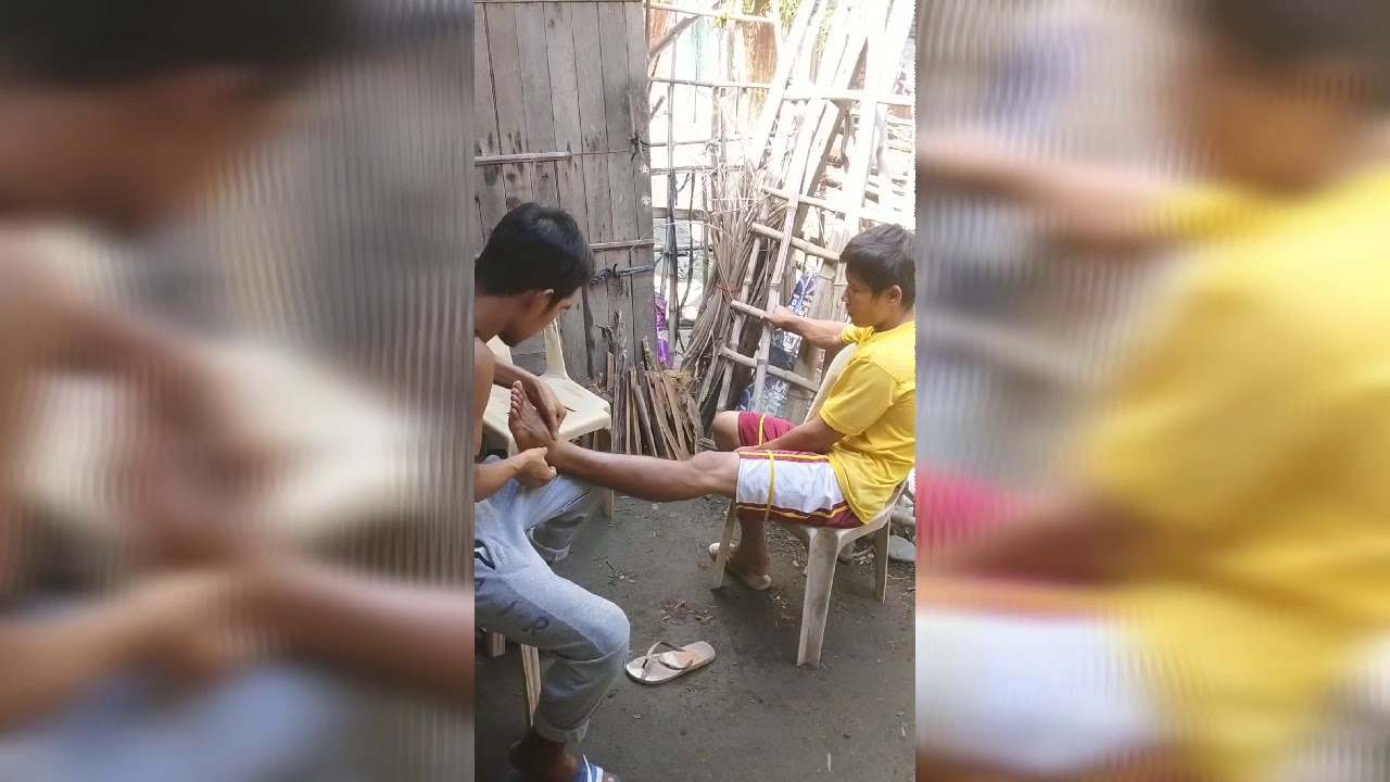 namamagang paa dahil sa pilay - YouTube
