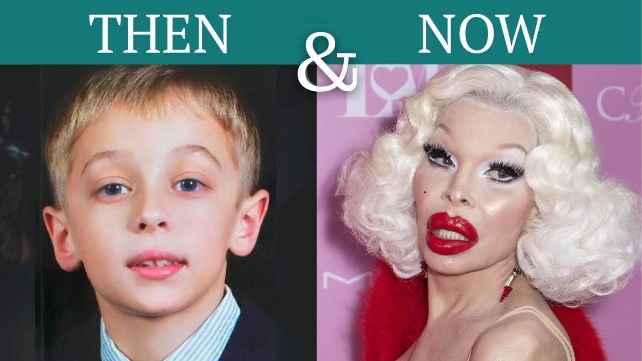 50 Hollywood ACTORS After Surgery – Then and Now - YouTube