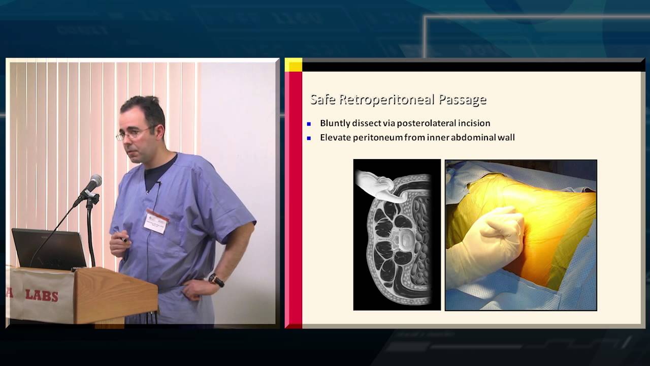 Lateral Deformity Surgery - YouTube