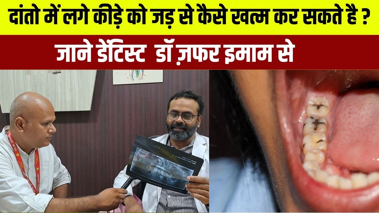 How can we eliminate the worms from teeth? Meet dentist Dr Zafar Imam ...