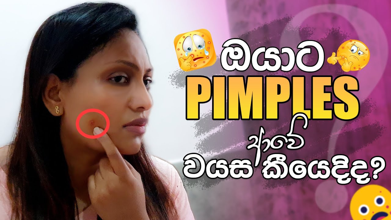 ඔයාට Pimples ආවේ වයස කීයෙදිද?Simple solution for Pimples | Pink Room 💕 ...