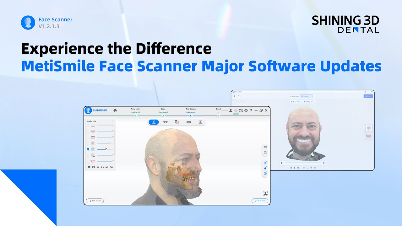 Experience the Difference｜MetiSmile Face Scanner Major Software Updates ...