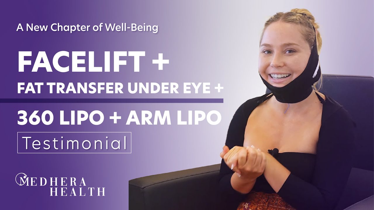 Facelift + Fat Transfer Under Eye + 360 Lipo + Arm Lipo Testimonial w ...