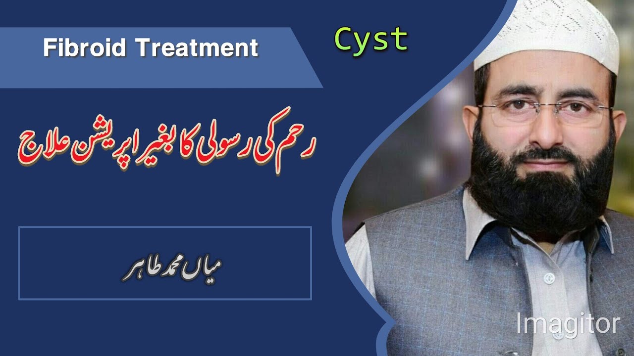 fibroid Treatment (bacha Dani ki rasoli ka ilaj).رحم کی رسولی کاعلاج ...