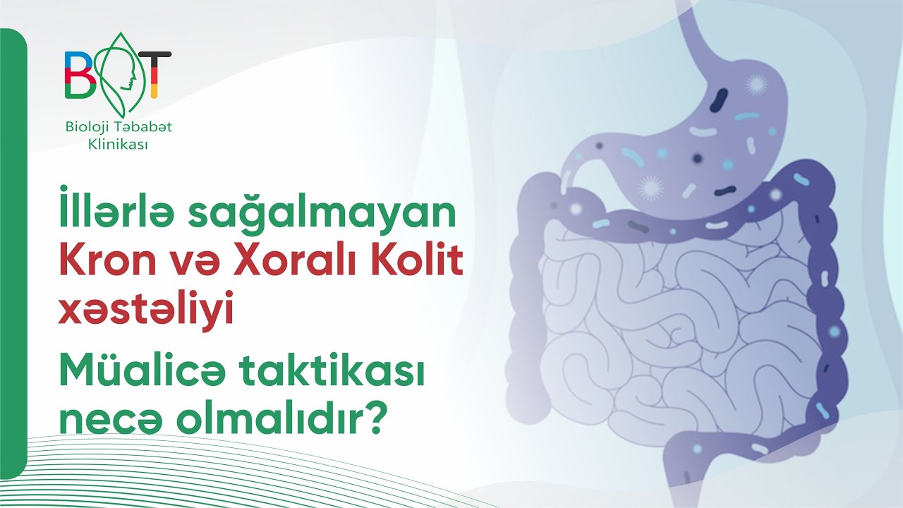 Kron və xoralı kolit xəstəliyi olan pasiyentlər öz xəstəlikləri barədə ...