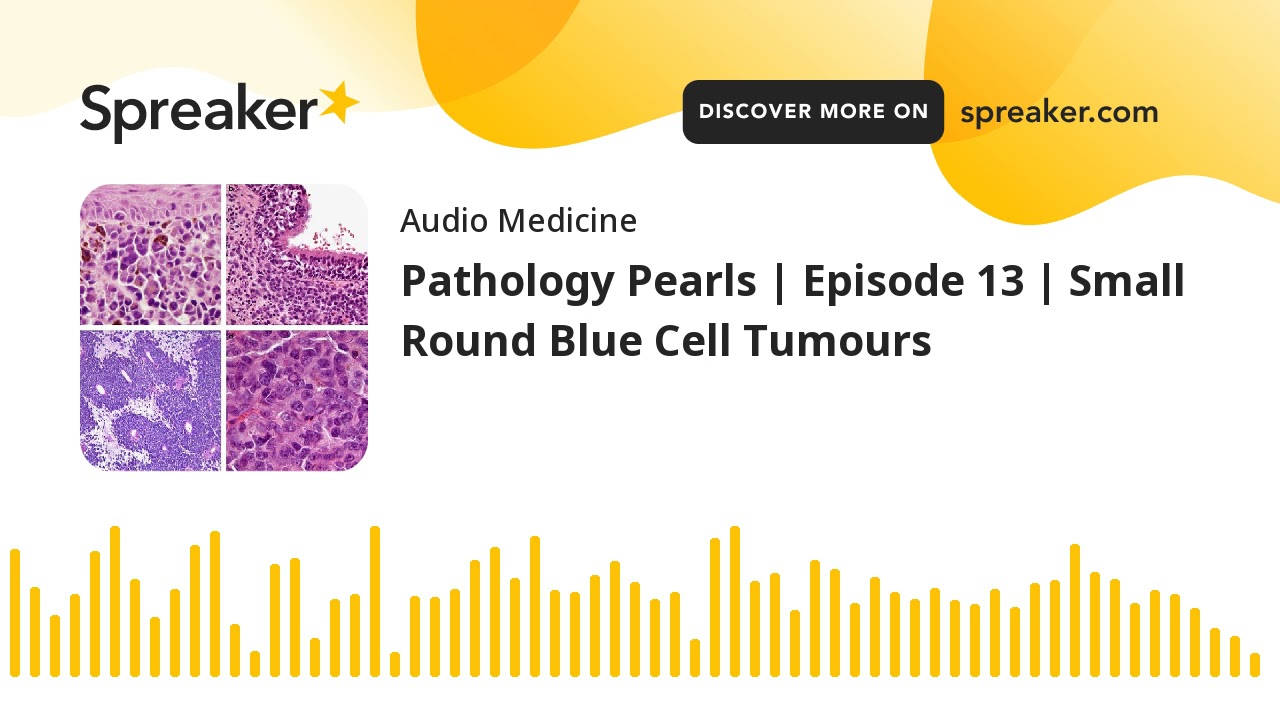 Small Round Blue Cell Tumors: What are they? - YouTube