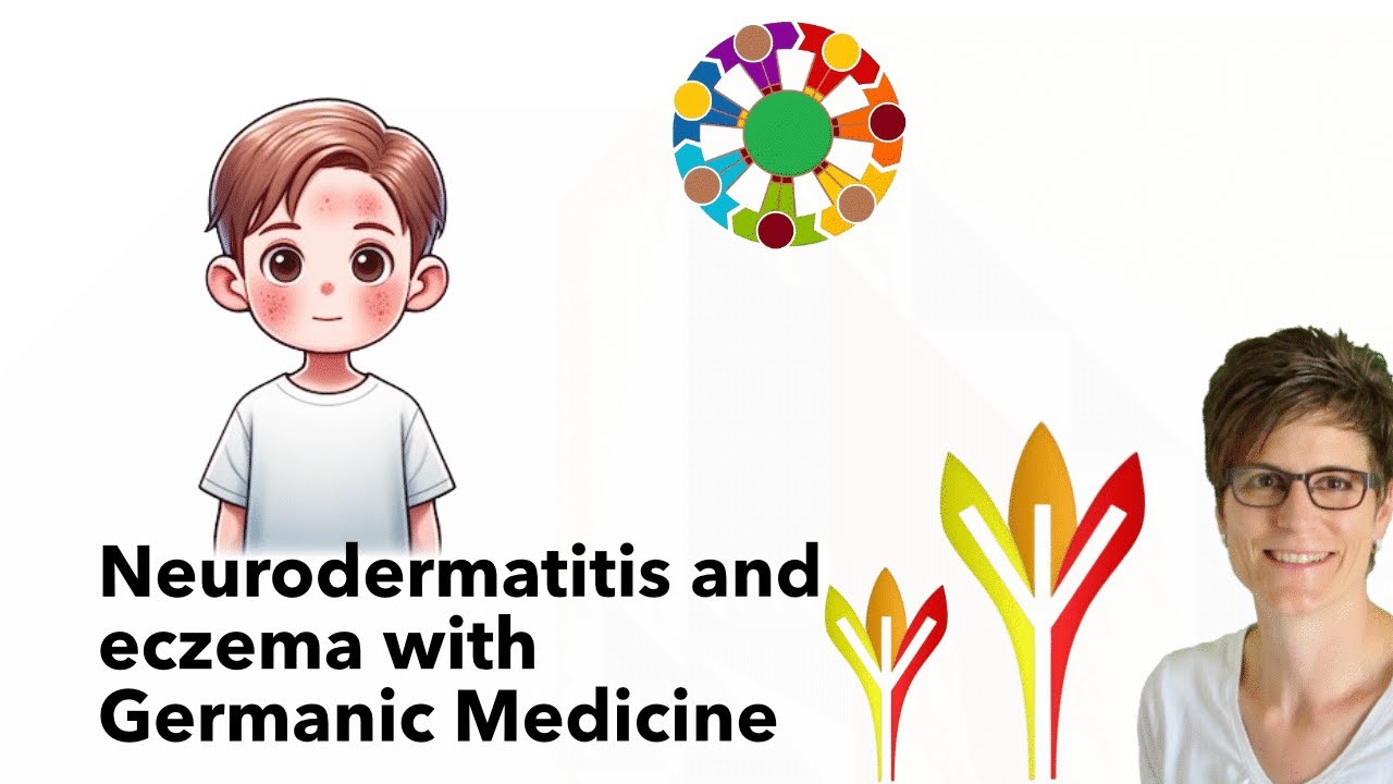 Neurodermatitis and eczema, Germanic Medicine, Dr. Hamer - YouTube